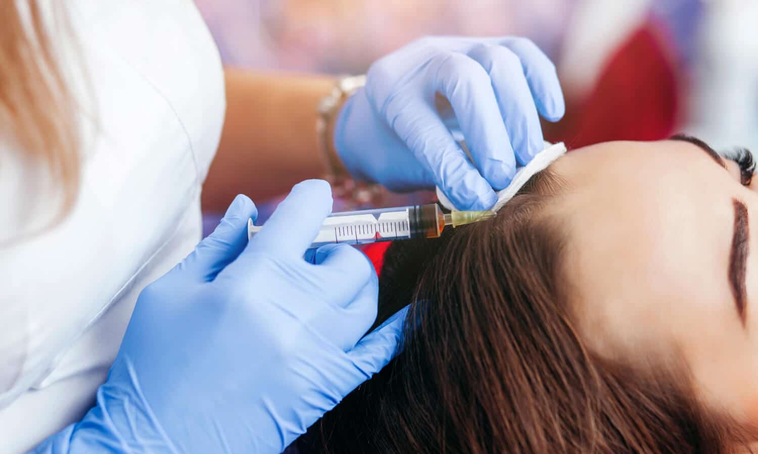 How PRP Injections Treat Hair Loss for Men and Women? - Impact Cosmetics