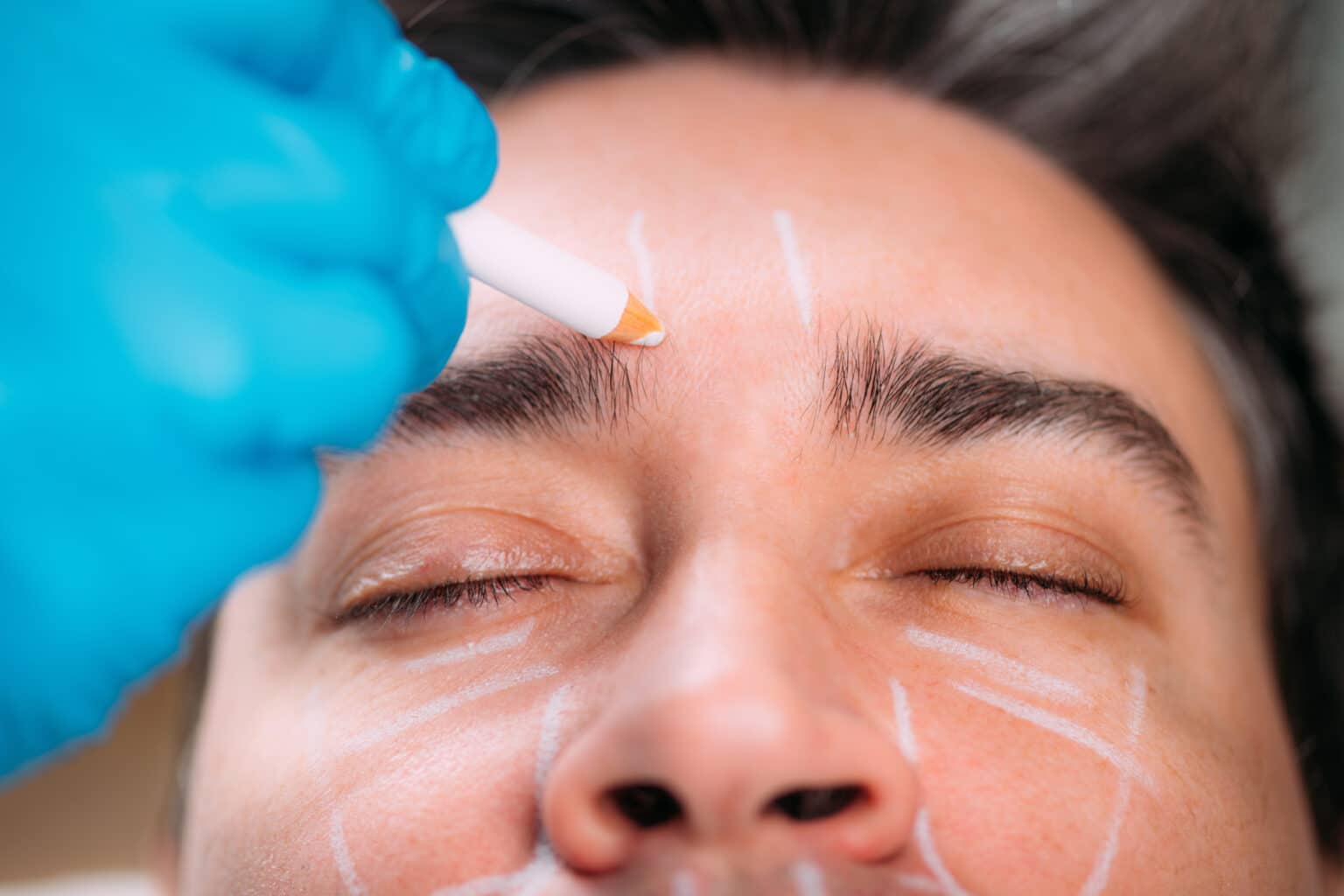 The Rise of Dermal Fillers Among Men: What to Know - Impact Cosmetics ...