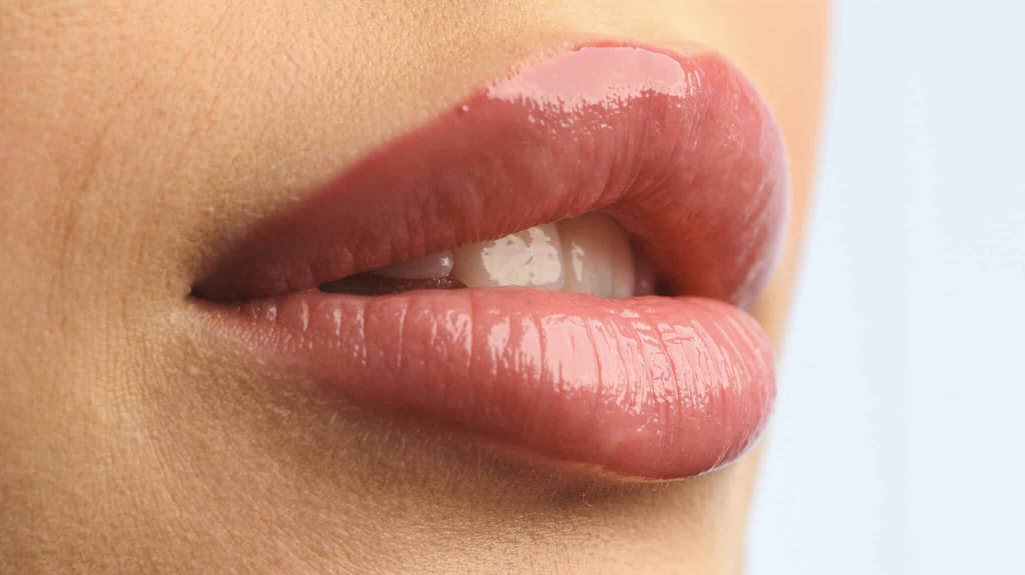 Lip Fillers Oakville | Get the Perfect Pout